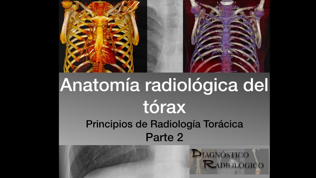 Aprende la anatomía radiológica del tórax. Principios de Radiología ...